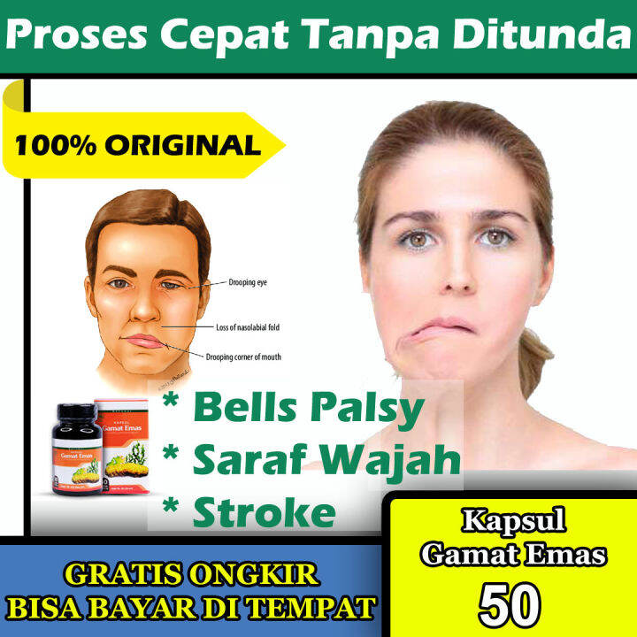 Obat Bells Palsy Obat Muka Miring Obat Bibir Mencong Obat Wajah Turun Sebelah Kanan Kiri