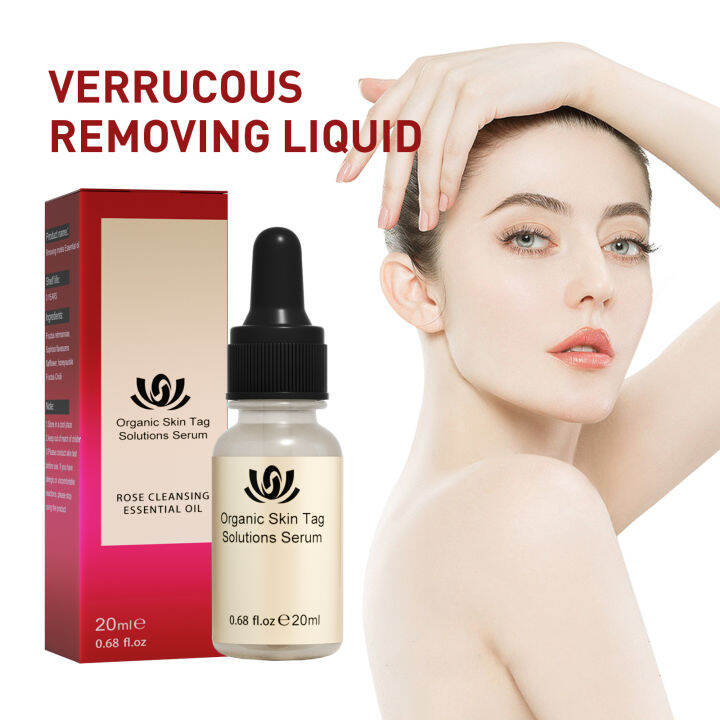 Wart Removal Traceless Mole Essential Oil Desalination Skin Verruca ...