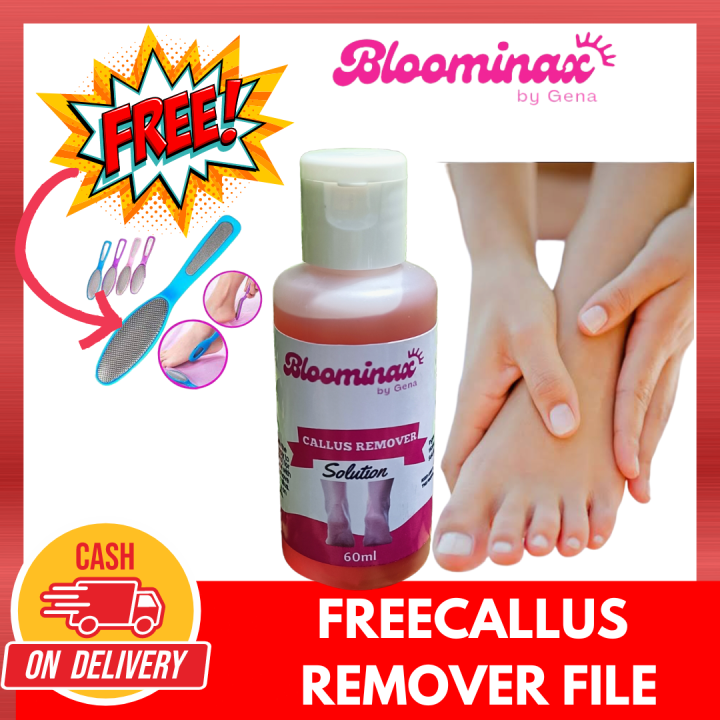 Bloominax callus peel solution pangtanggal kalyo sa paa at kamay 60ml/callus removal for foot ...