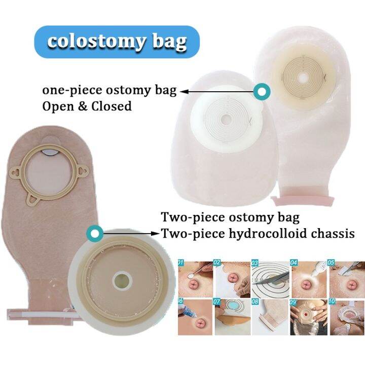 One-piece/Two-piece Colostomy Bags Open Closed Closing Bags Ostomy Bags ...