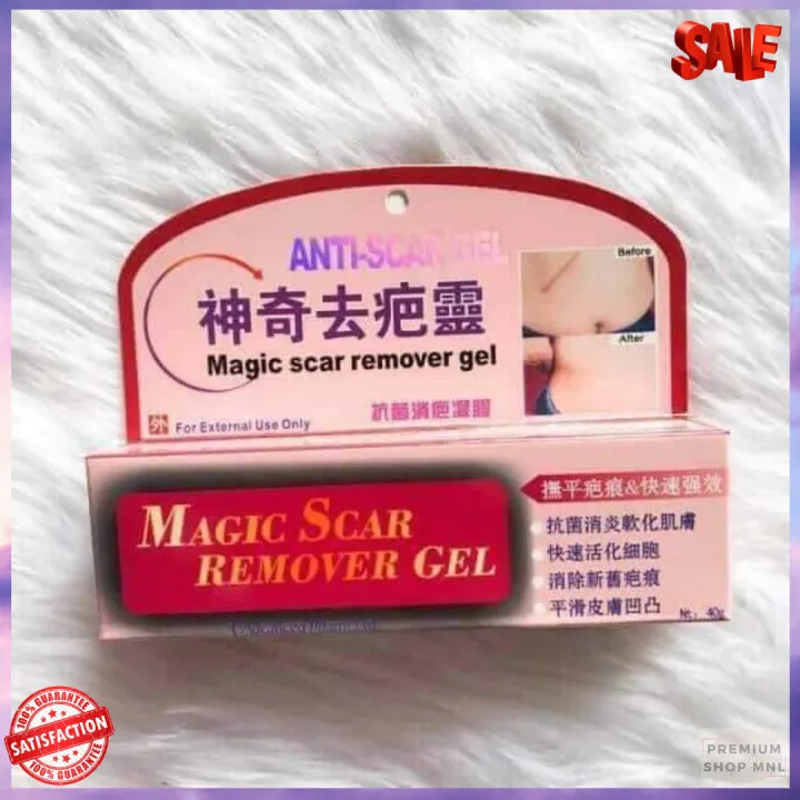 Scar Remover Effective Magic Scar Mabisang pangtanggal PEKLAT PIMPLE ...