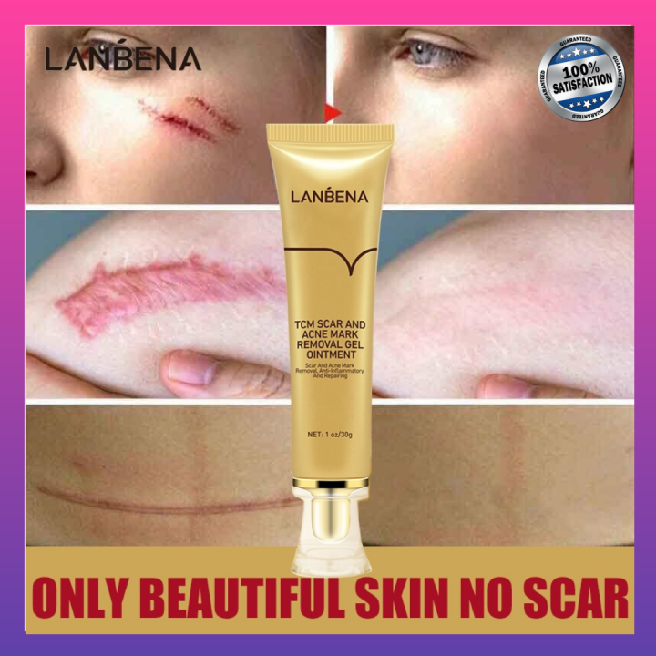 TCM Scar Removal Cream Acne Treatment Acne Control Acne Scar Removal ...
