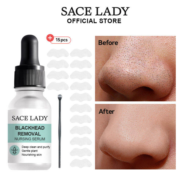SACE LADY Blackhead Remover Serum Gentle Deep Cleansing Pore Unclogging ...
