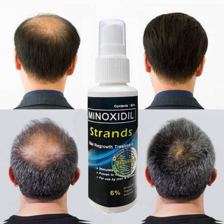 Beard And Hair Growth Spray Original Minoxidil Strands 6 Hair Grower