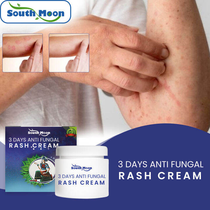 South Moon Anti Fungal Cream Psoriasis Cream Relieve Redness Itching ...