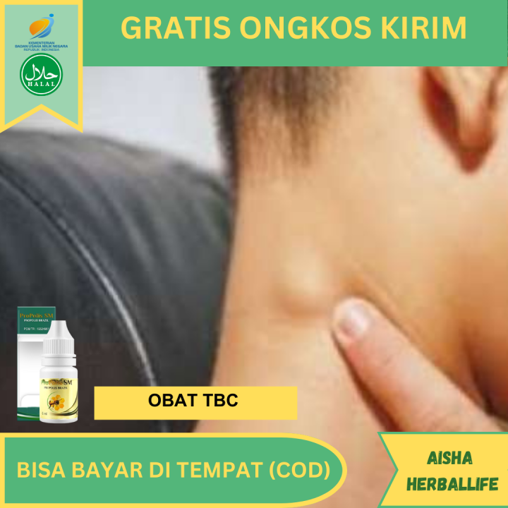 Propolis SM-Obat Penyakit TBC 100% Asli Dari Ekstrak Propolis Brazilian Green With Nano ...
