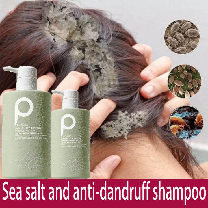 ORIGINAL Sea Salt Shampoo Anti Dandruff Shampoo Psoriasis Shampoo For Scalp Itching Hair ...