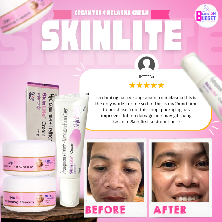 SKINLITE CREAM TUB and TUBE 25g Made In India | Lazada PH
