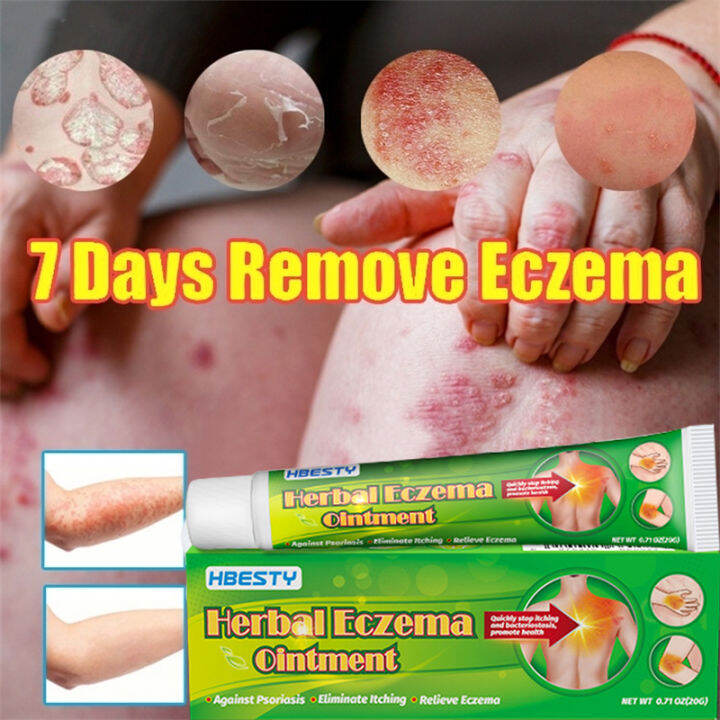 🔥100%ORIGINAL🔥Arturo Doctor Gamot sa sakit sa balat Skin Herbal ...