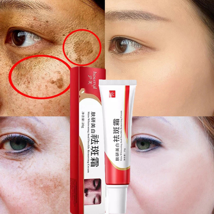 Erya Shop Whitening Freckle Cream Melanin Moisturizing Hydrating Skin ... Erya Shop Whitening Freckle Cream Melanin Moisturizing Hydrating Skin ...
