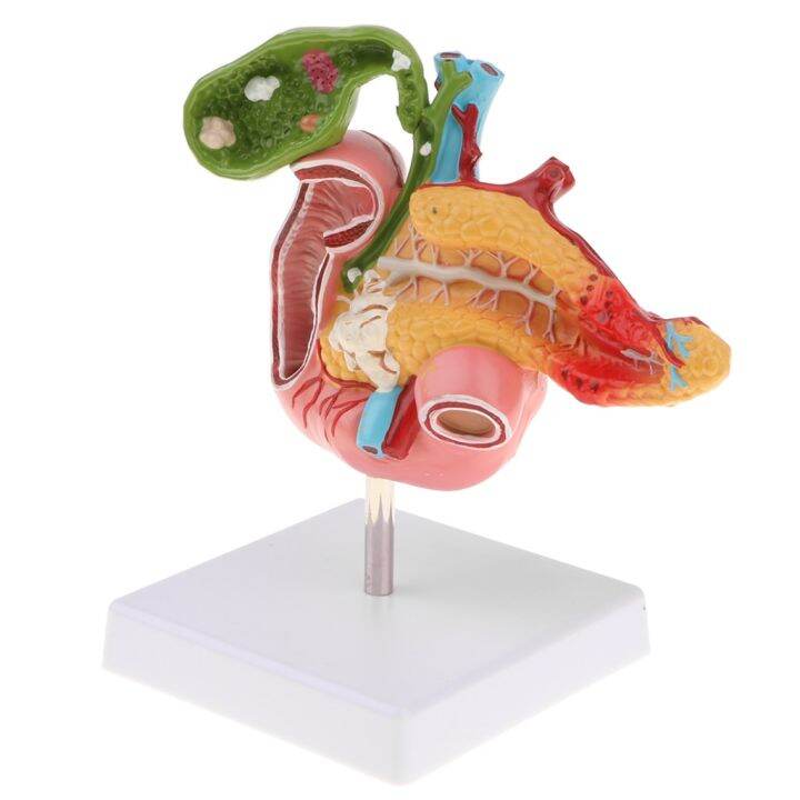 1:1 Life Size Anatomical Human Pancreas Duodenum Gallbladder Pathology ...