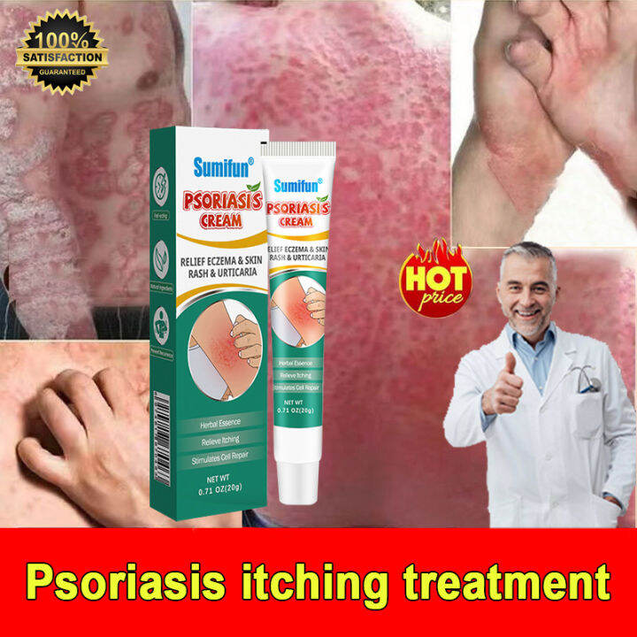 Psoriasis Eczema Ointment Treatment Cream Herbal Antibacterial Cream for Itchy Skin Allergy ...