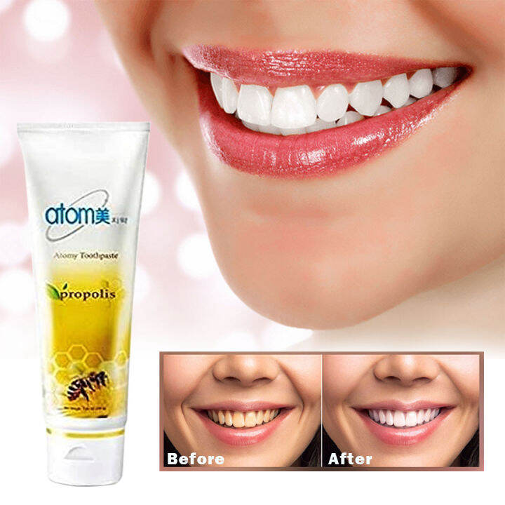 Atomy Toothpaste 200g Made in Kolmar Korea | Lazada PH
