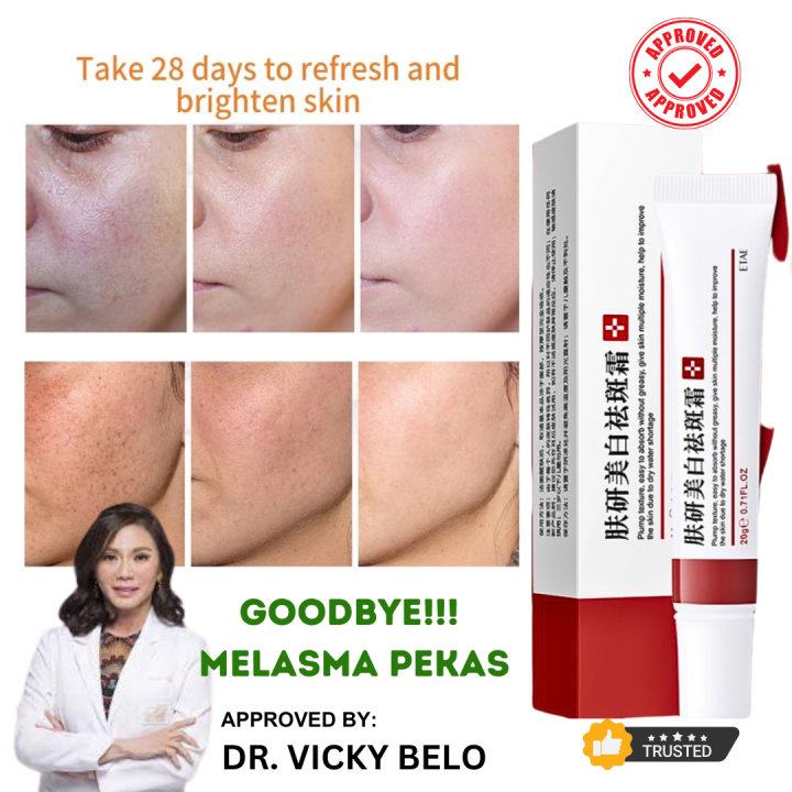 ORIGINAL 100% EFFECTIVE MELASMA CREAM PEKAS FRECKLE REMOVAL CREAM ACNE ...