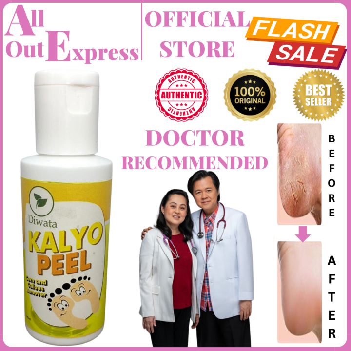 DIWATA KALYO PEEL 60ml. Legit. Corn & Callous remover. Softens and ...