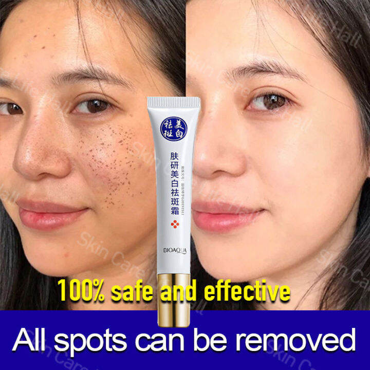 【COD】Whitening freckle dark spot remover Face Care Freckle Repair ...