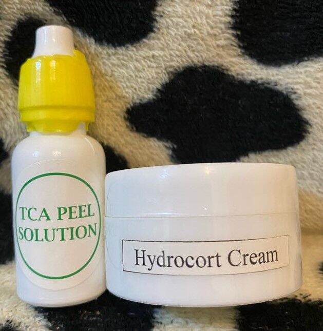 TCA Peel 10% 20ml and hydrocort cream | Lazada PH