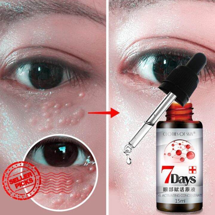 Instant Fat Removal-7 Days Eye Cream Remove Eye Bags and Care Fat Eye ...