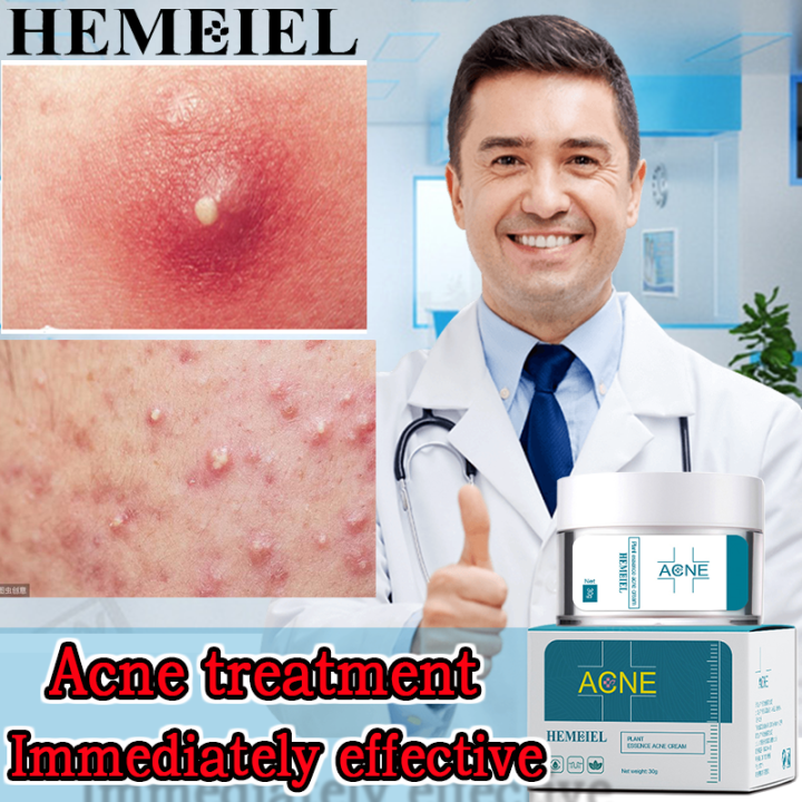 HEMEIEL Acne Treatment Set/Gamot Sa Pimples Cream/Pimples Remover ...