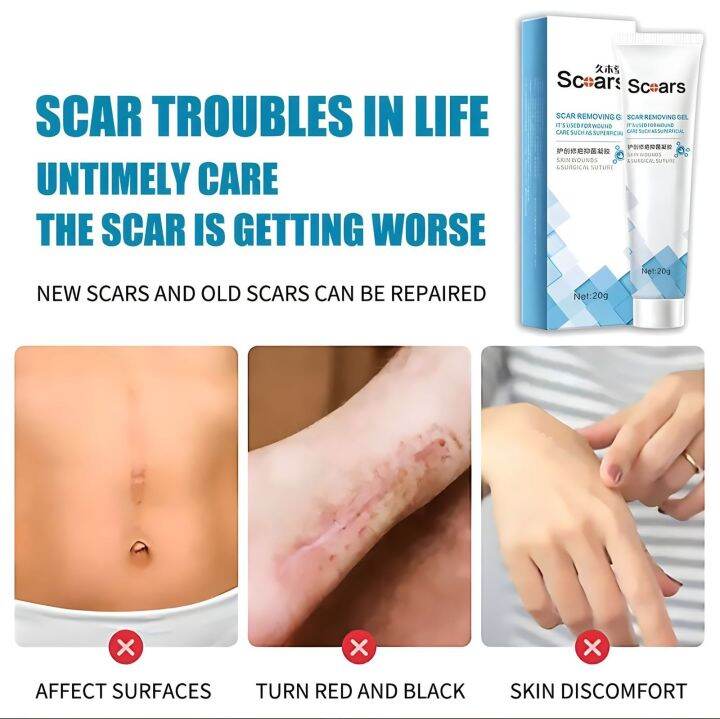 Tattielove Scar repair cream Scar Remover -Remove old Scars on legs ...
