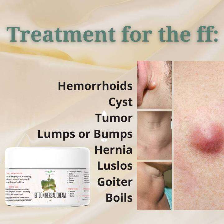 BITOON CREAM Lipoma Removal Cream 20G Lipoma Removal Cream Original ...