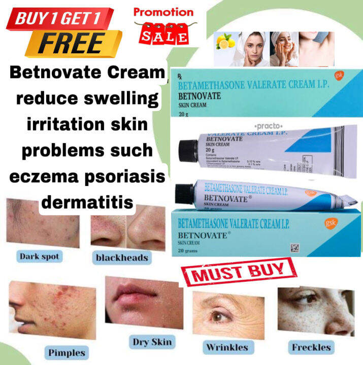 Betnovate Skin Cream Buy 1 Take 1 Blue | Lazada PH