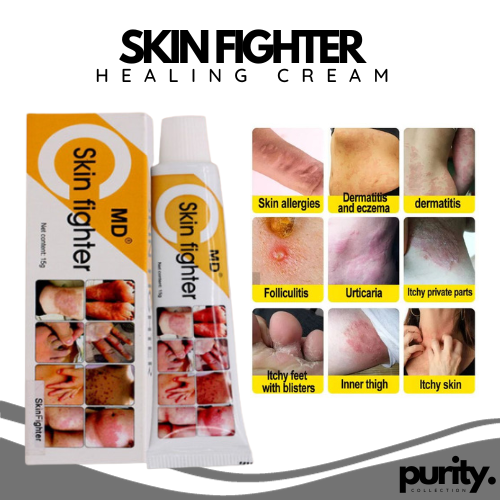 MD Skin Fighter Cream - 15g Using Part for Skin Is Hand/ feet ringworm ...