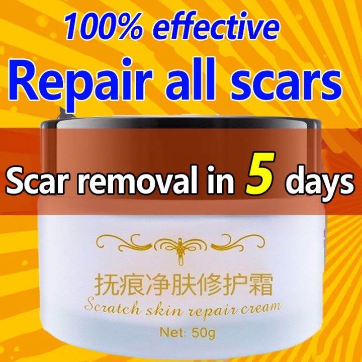 ZWER scar remover for old scar on leg 50g Old Scar Scar Remover Cream ...