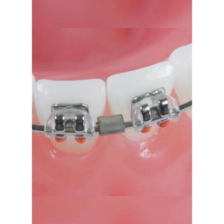 Dental Crimpable Hook Split stops | Lazada Indonesia