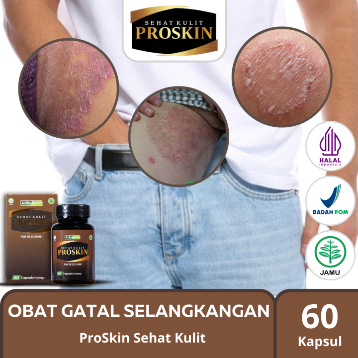 Proskin Sehat Kulit Obat Selangkangan gatal dan hitam, Obat ...
