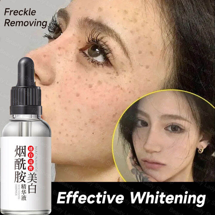 Original Niacinamide Whitening Freckle Serum 100% effective anti melasma serum melasma remover ...