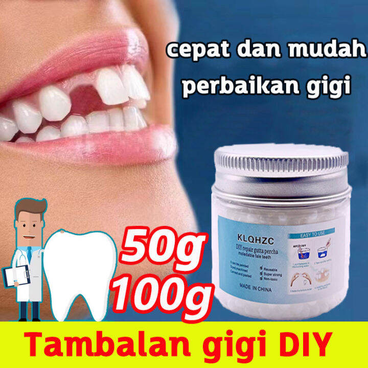 Penambal Gigi Berlubang Temptooth Isi 50g Lem gigi Sementara Gigi dan ...