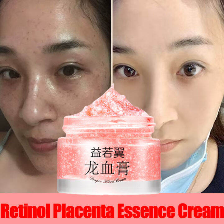 Retinol moisturizing cream dragon blood cream anti-wrinkle whitening ... Retinol moisturizing cream dragon blood cream anti-wrinkle whitening ...
