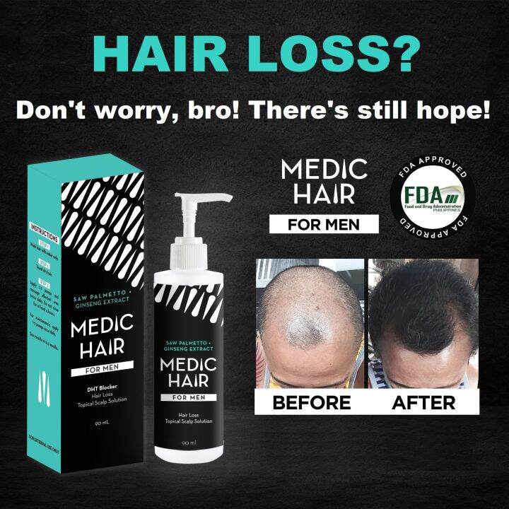 Nutriplus Medic Hair Topical Hair Growth Solution | Lazada Singapore
