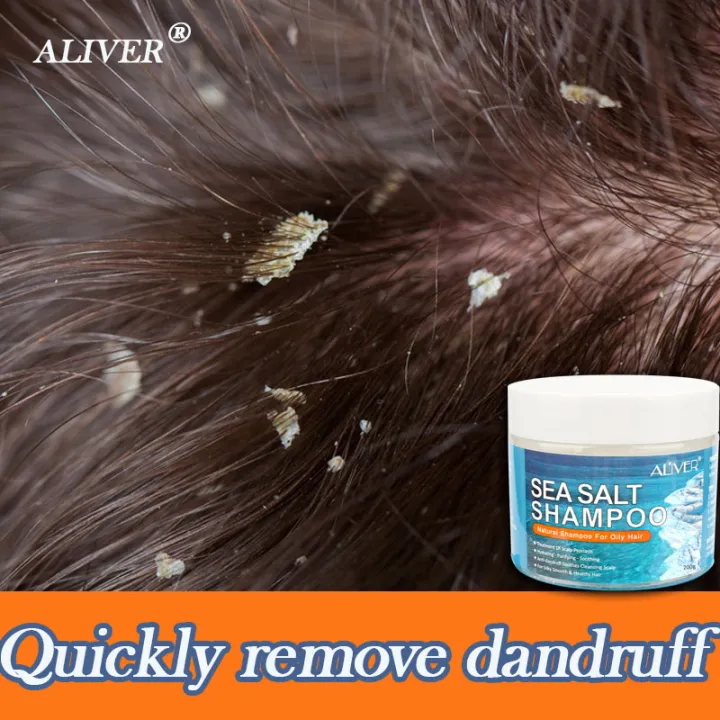 Quickly Remove Dandruff Aliver Sea Salt Shampoo Anti Dandruff Deeply