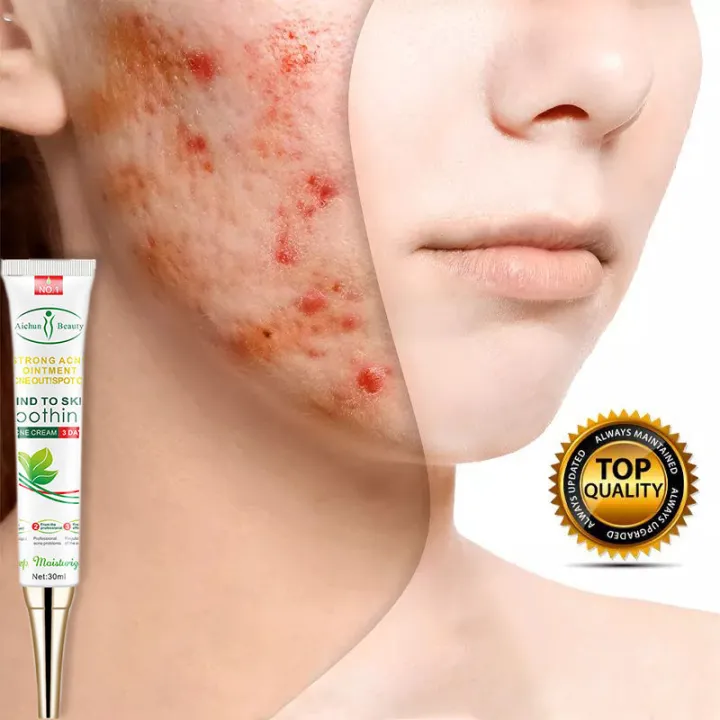 Buy 2 Take 1 【COD】Acne Pimple Eraser Anti Acne And Pimples Acne Removal ...