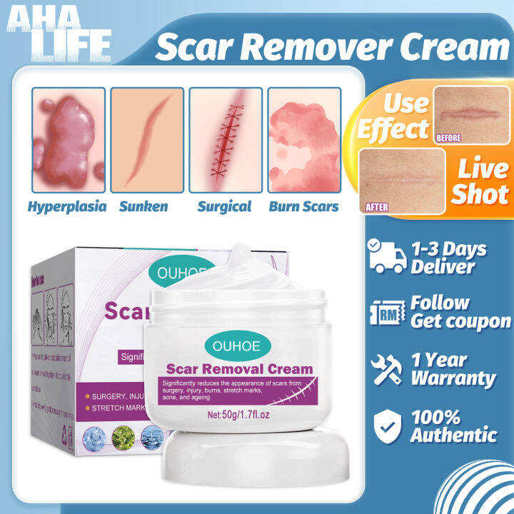 Scar Remover Cream For Body Stretch Mark Cream For Pregnancy Scar Acne ...