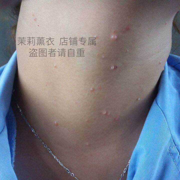 Molluscum contagiosum children and pregnant women can gently remove ...