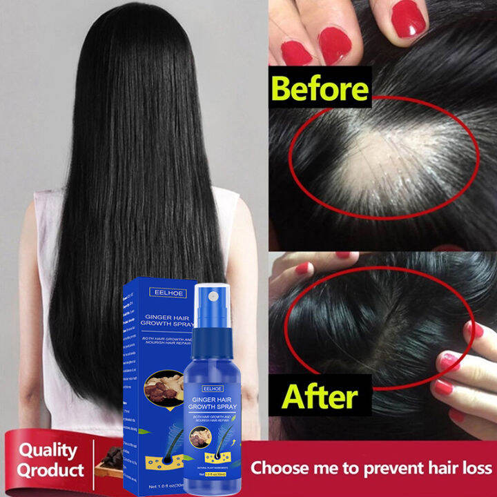 Eelhoe Ginger Hair Growth Spray Serum Anti Hair Loss Products Fast
