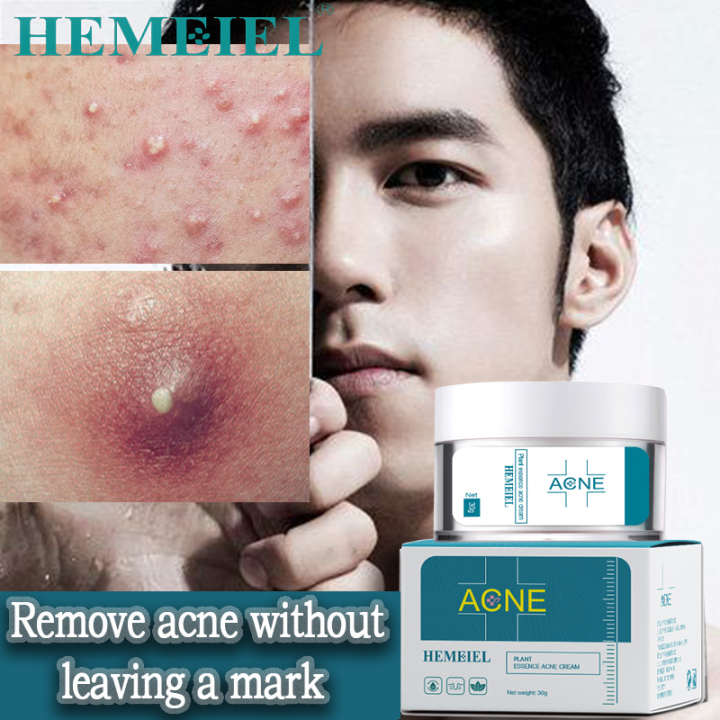 HEMEIEL Acne Cream/Acne Scars Remover For Face/Pimple Remover/acne ...