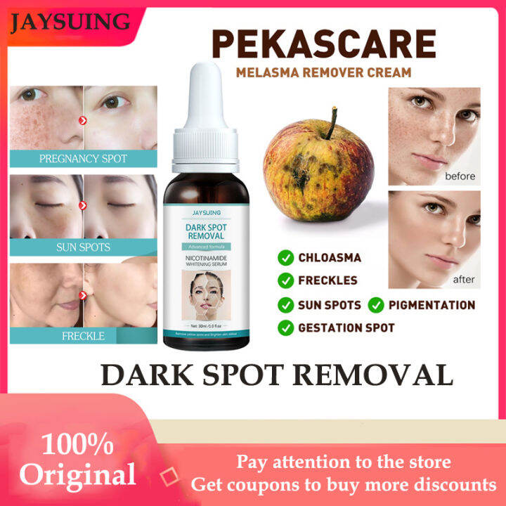PEKAS REMOVER CREAM / MELASMA CREAM Melasma Pekas Care niacinamide Dark ...