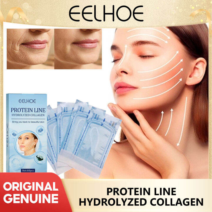 Eelhoe Protein Line Collagen Absorbable Lifting Thread Anti-Wrinkle V ...