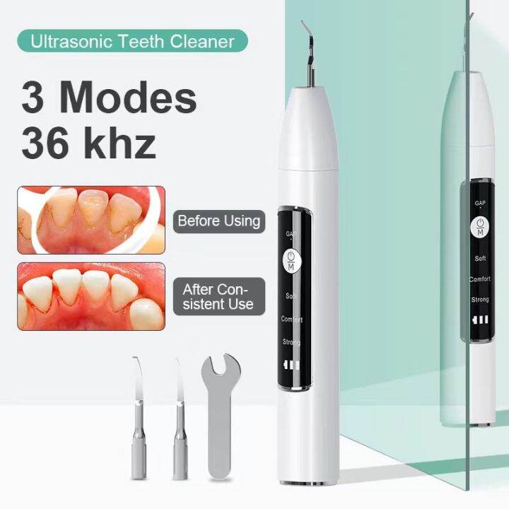 Tooth Cleaner Tartar Ultrasonic Tartar Remover Smart Ultrasonic Teeth ...