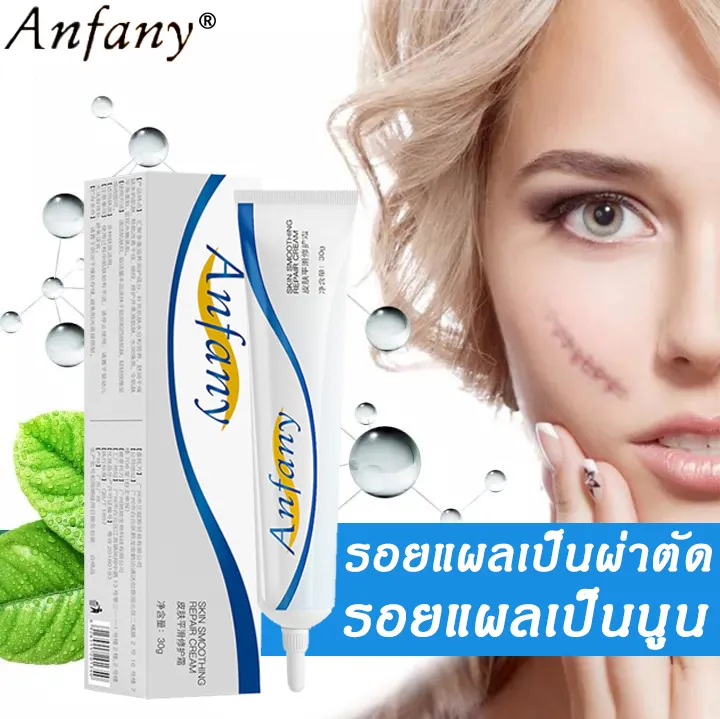 Anfany 30g ครีมทารอยแผลเป็น ทารอยแผลเป็น รอยเเผลเป็น ครีมทาแผลเป็น ทาแผลเป็นนูน ครีมทารอยสิว แผล ...