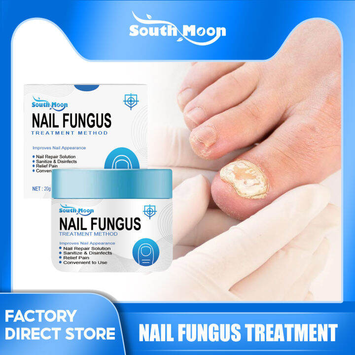 South Moon Nail Fungus Treatment Cream Anti Infection Cures