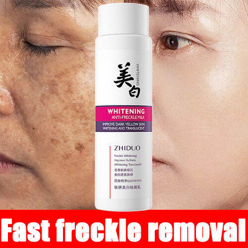 Spots Removal Cream Ultimate Pekas Cream 3-5days goodbye sumpa kana ...
