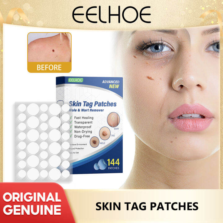 Eelhoe Wart Patch Wart Patch Chicken Eye Flesh Prick Wart Wart Flat ...
