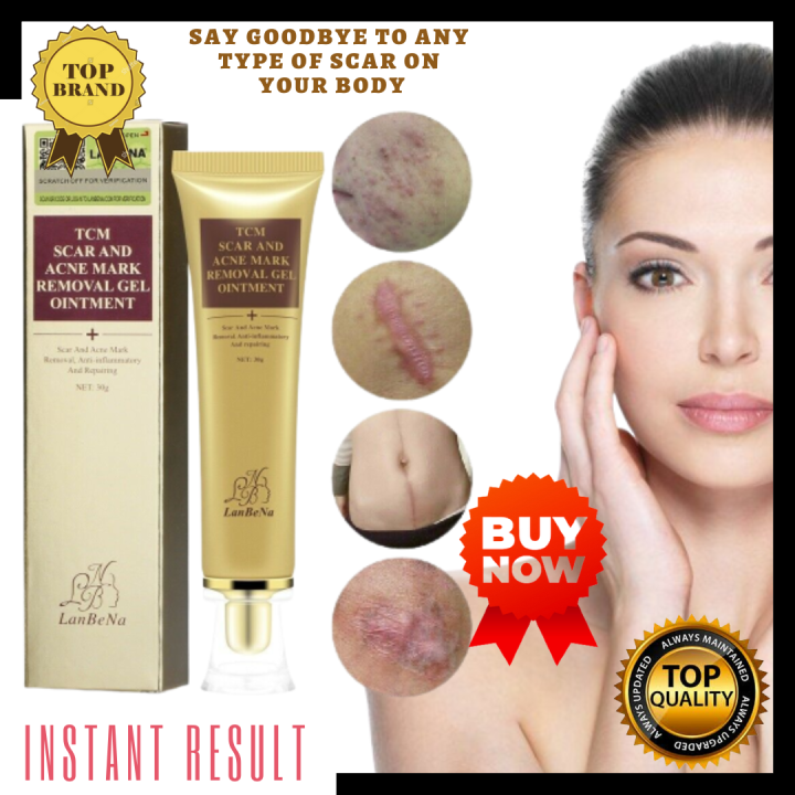 🎉100% Original Lanbena Tcm Scar Remover, Lanbena Tcm Acne Treatment ...