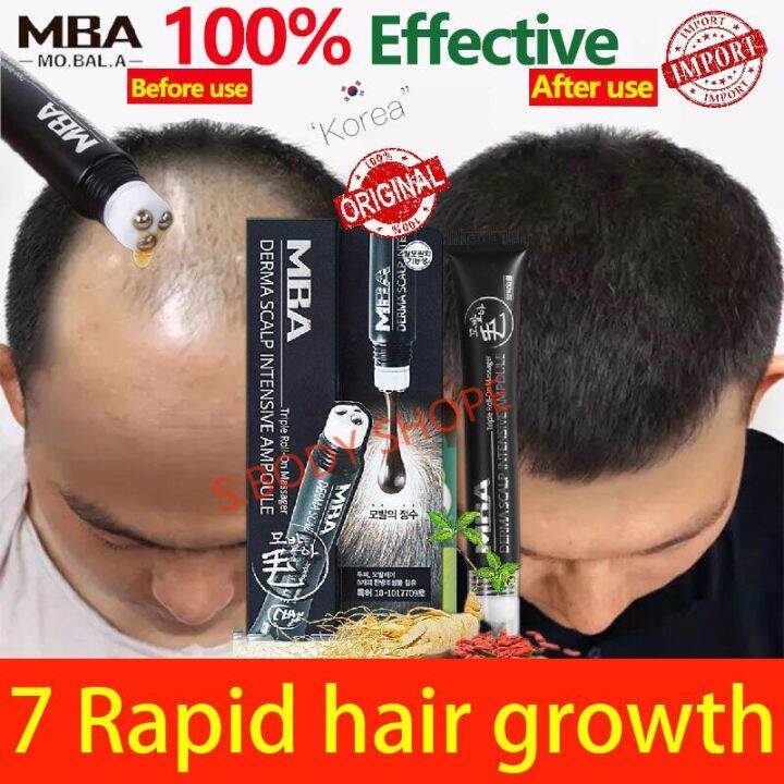 MBA Hair Growth massager 20ml Anti Hair Fall Fortifying Serum Anti Hair ...