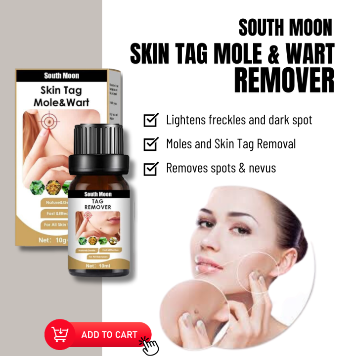 100% Effective South Moon Skin Tag Mole and Wart Skin Dark Spot for ...